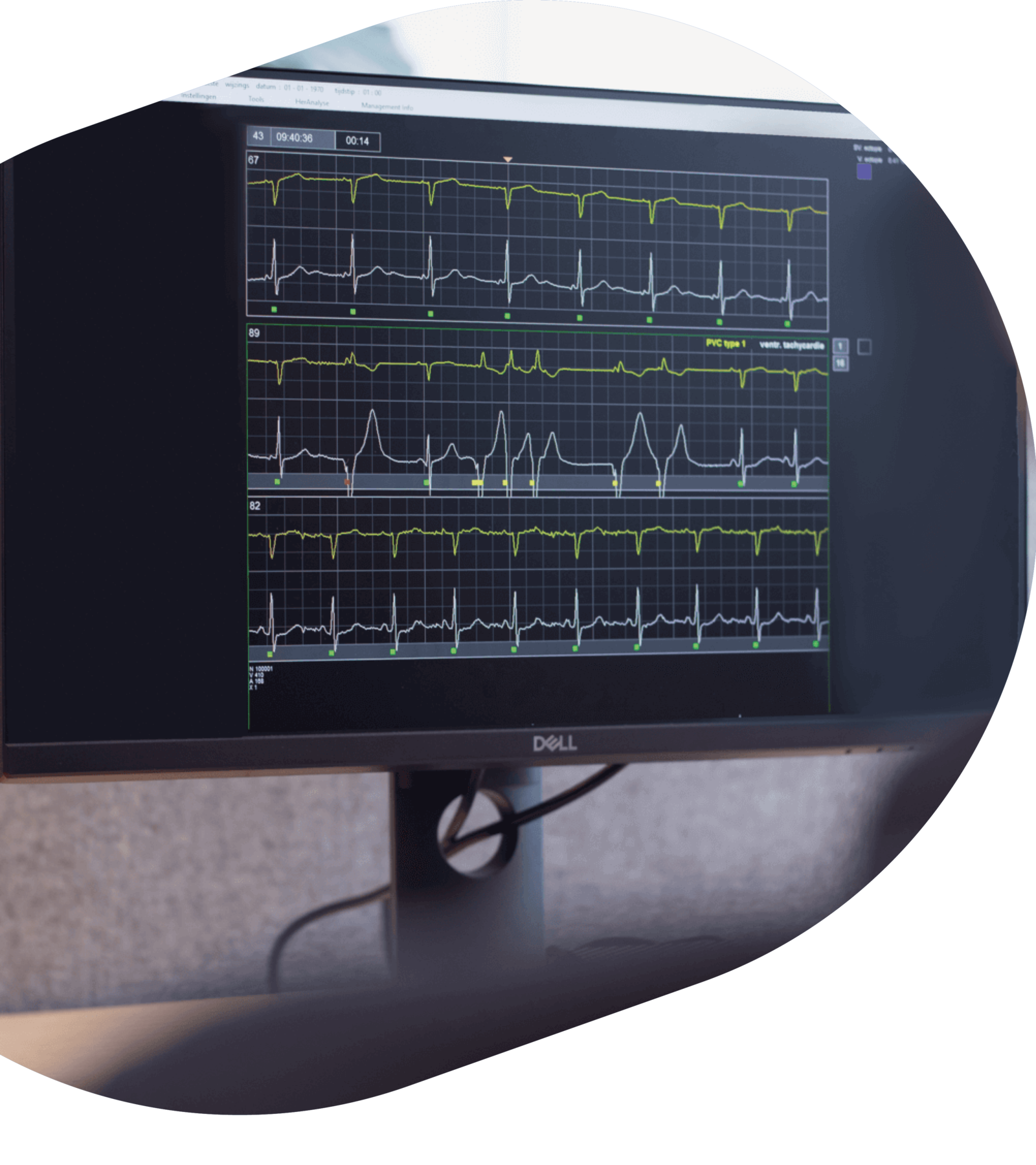 Holter-at-home service | Fysiologic | ECG examination at the patient's home